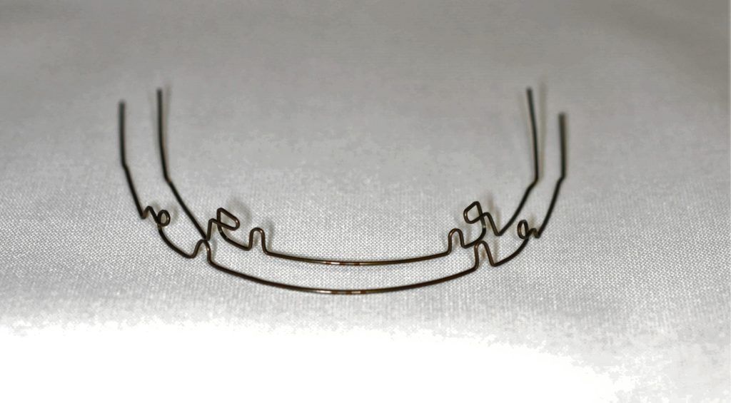 Non-surgical Orthodontic treatment » Frisco, TX - E Line Orthodontics Non-surgical Orthodontic treatment » Frisco, TX - E Line Orthodontics